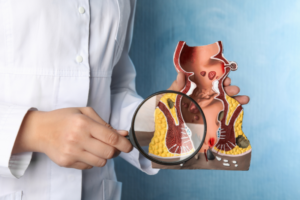 Thrombosed Hemorrhoids | Symptoms, Causes, and Treatments